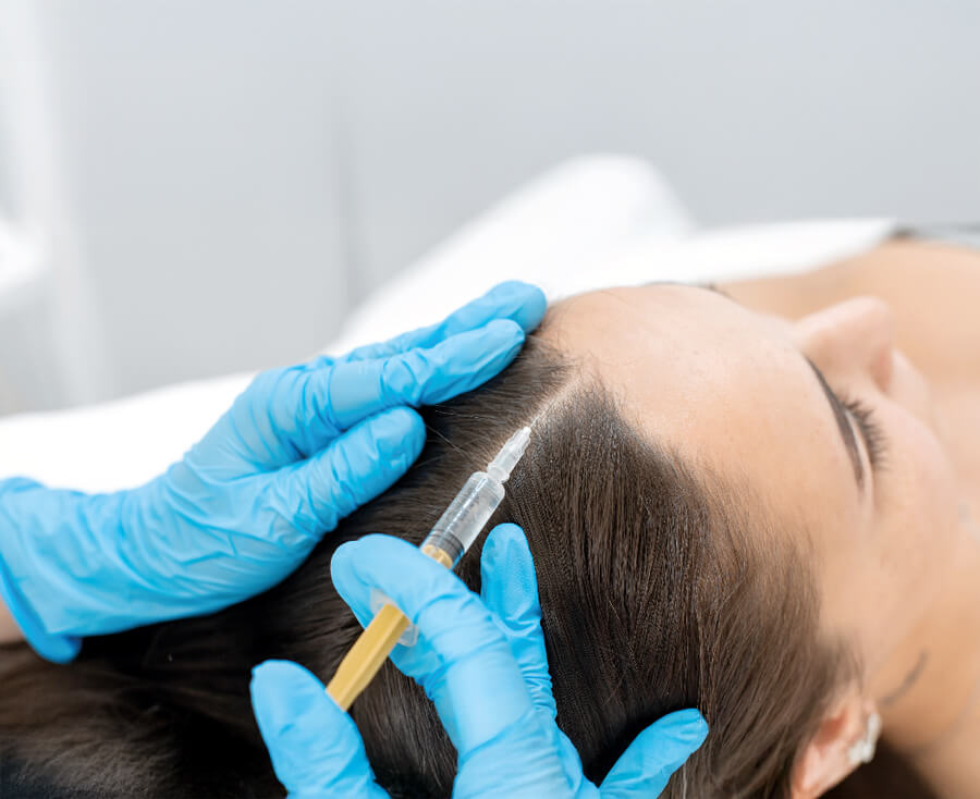 Mesoterapia Capilar - AGE